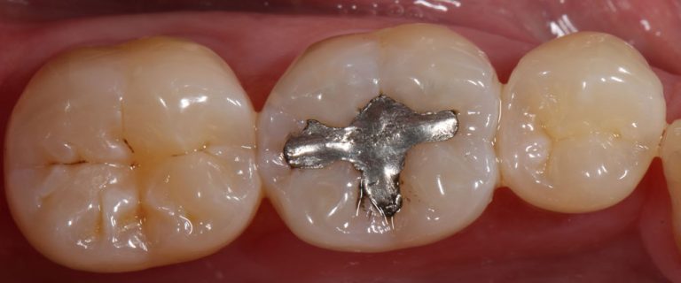 Restorative Dentistry - Margaron Dental Center