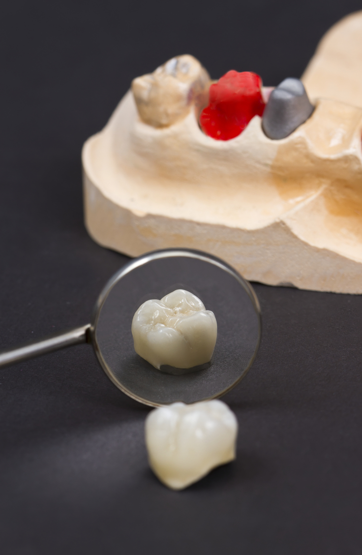 Prosthodontics - Margaron Dental Center